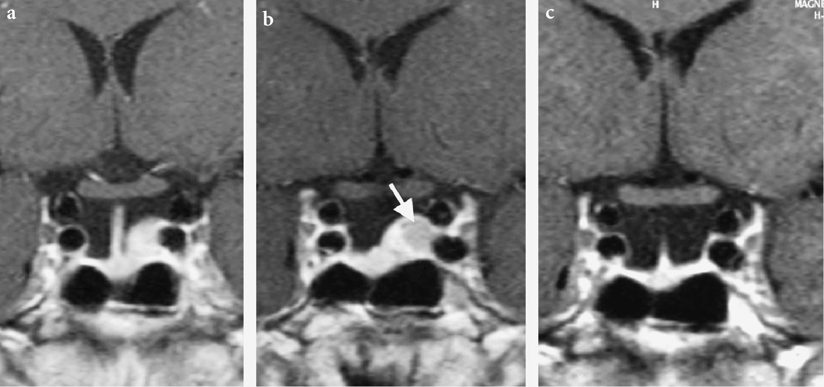 Neuro-imagerie diagnostique