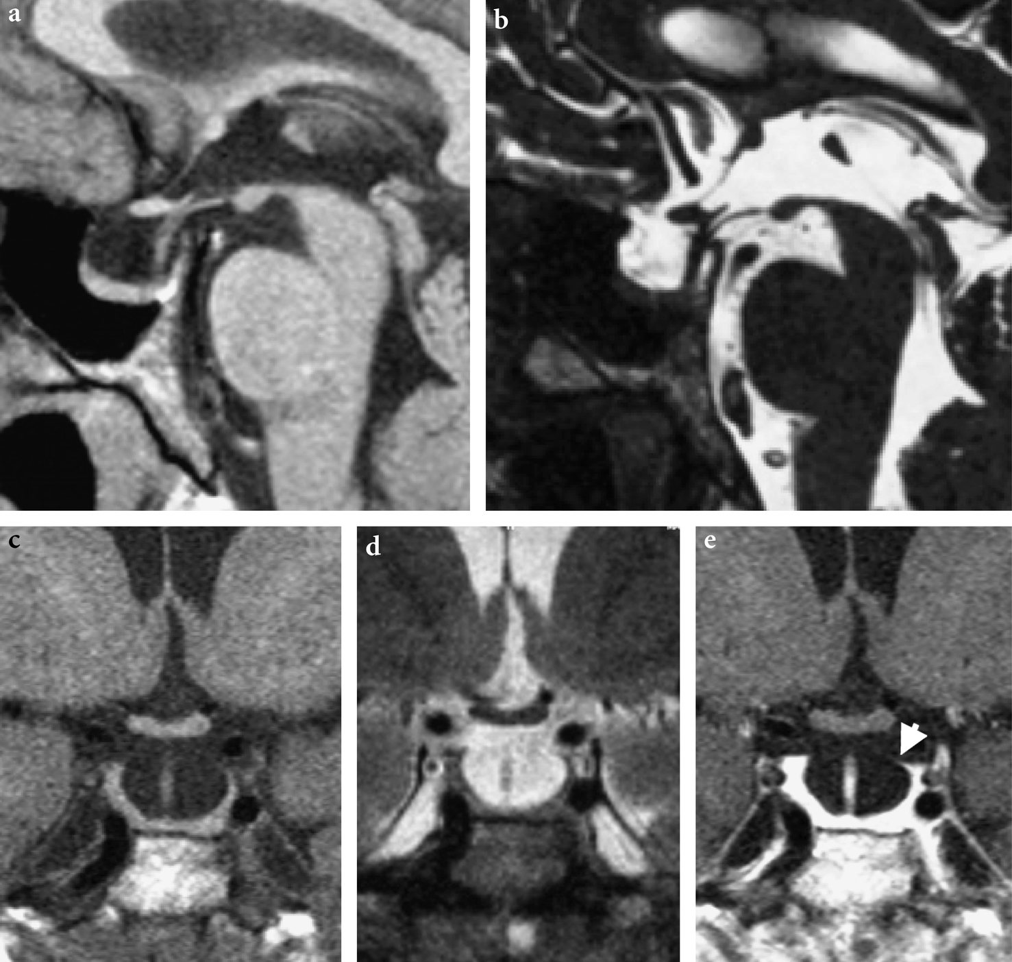Neuro-imagerie diagnostique