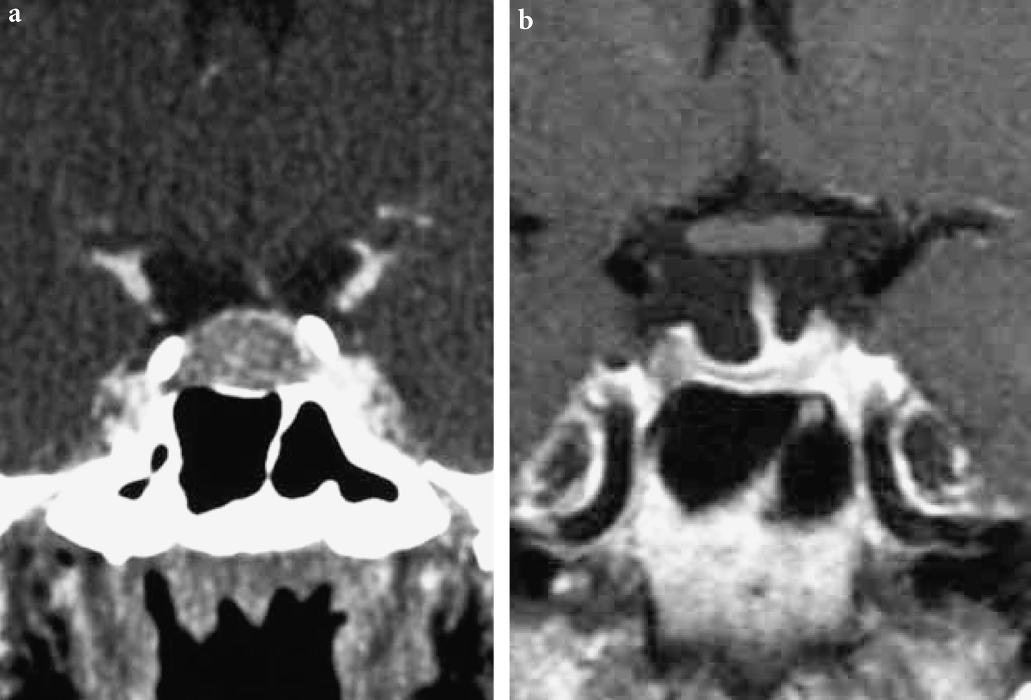 Neuro-imagerie diagnostique