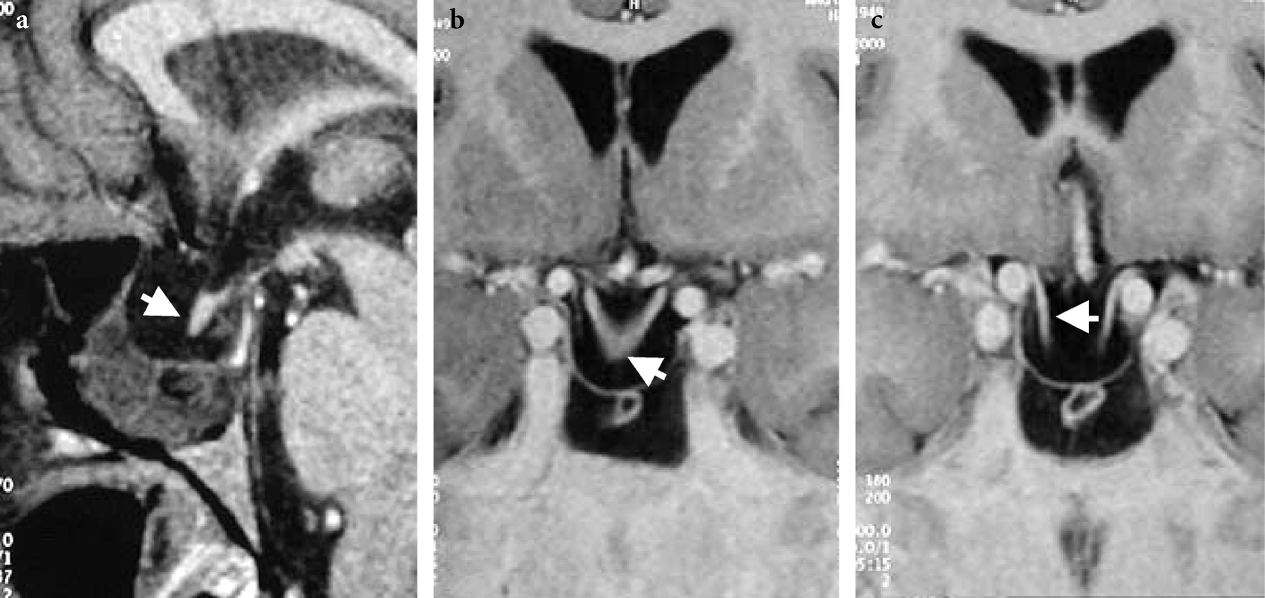 Neuro-imagerie diagnostique