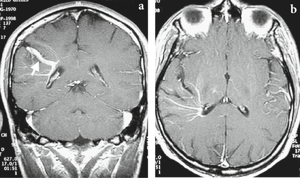 Neuro-imagerie diagnostique