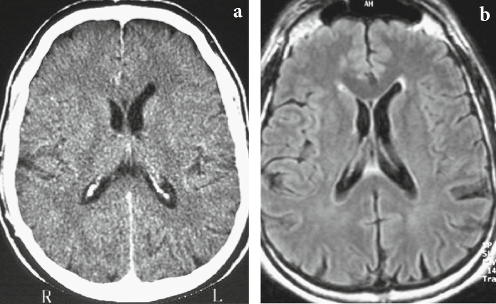 Neuro-imagerie diagnostique