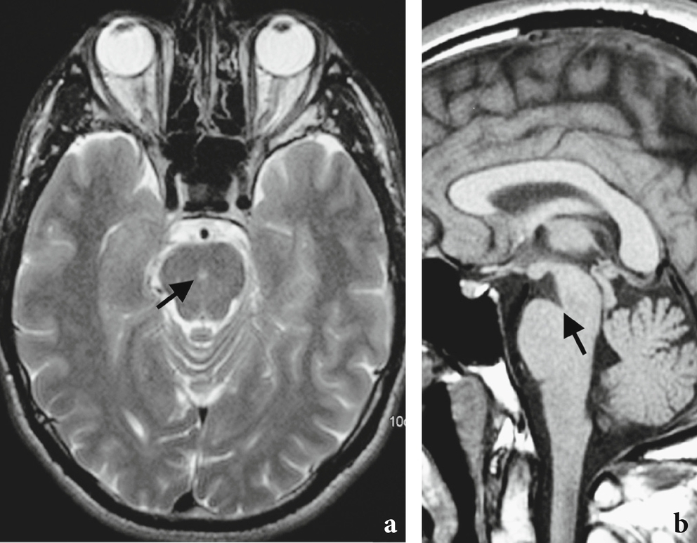 Neuro-imagerie diagnostique
