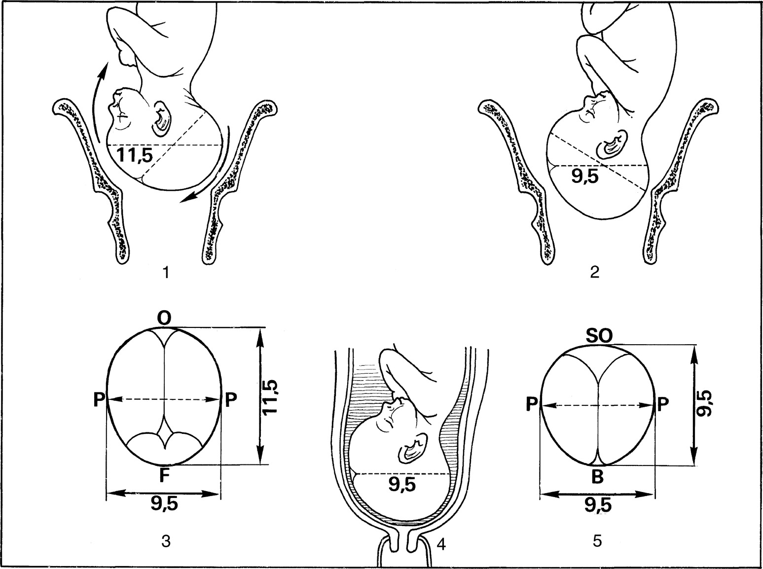 Pratique de l'accouchement