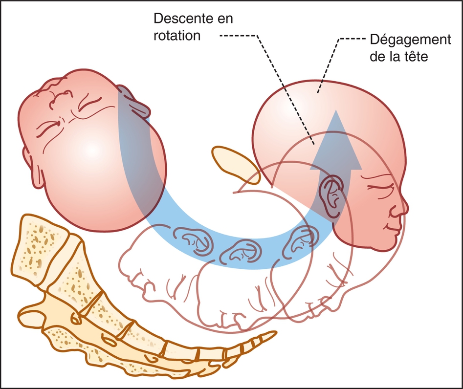 Pratique de l'accouchement