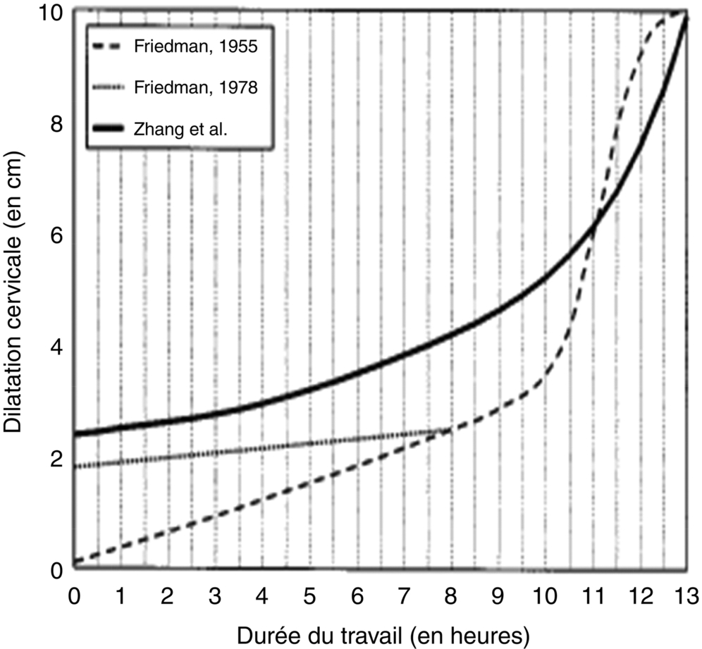 Pratique de l'accouchement