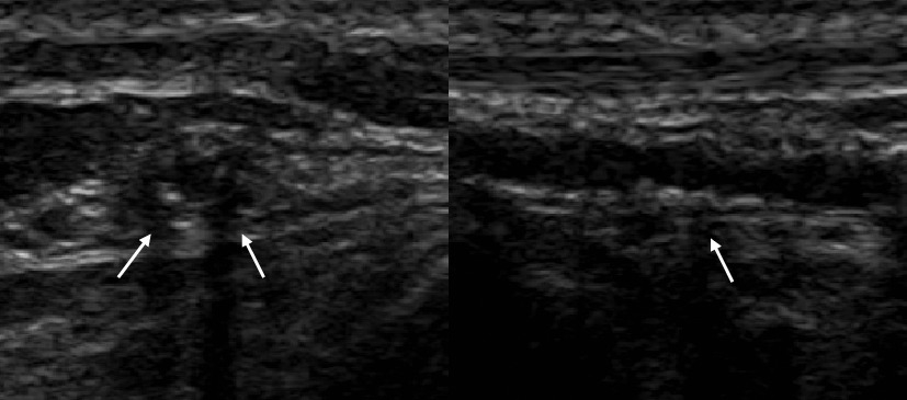 Guide pratique d'écho-Doppler vasculaire