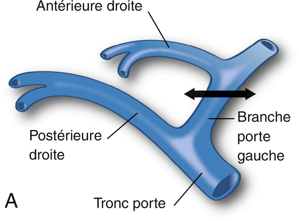 Guide pratique d'écho-Doppler vasculaire