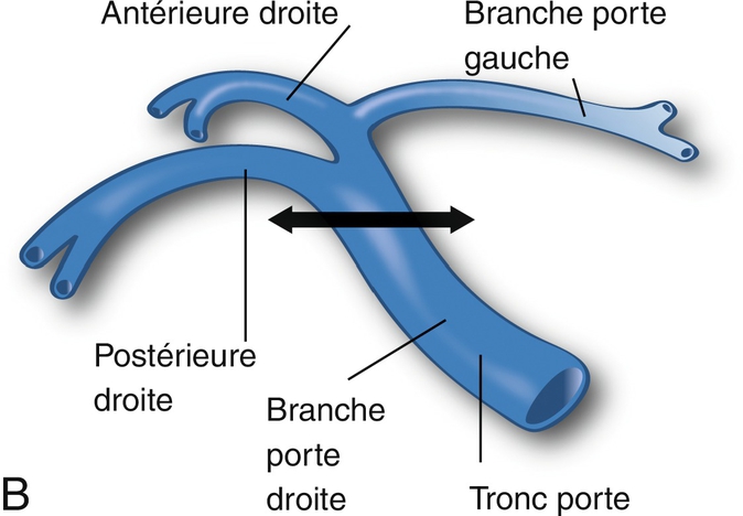 Guide pratique d'écho-Doppler vasculaire