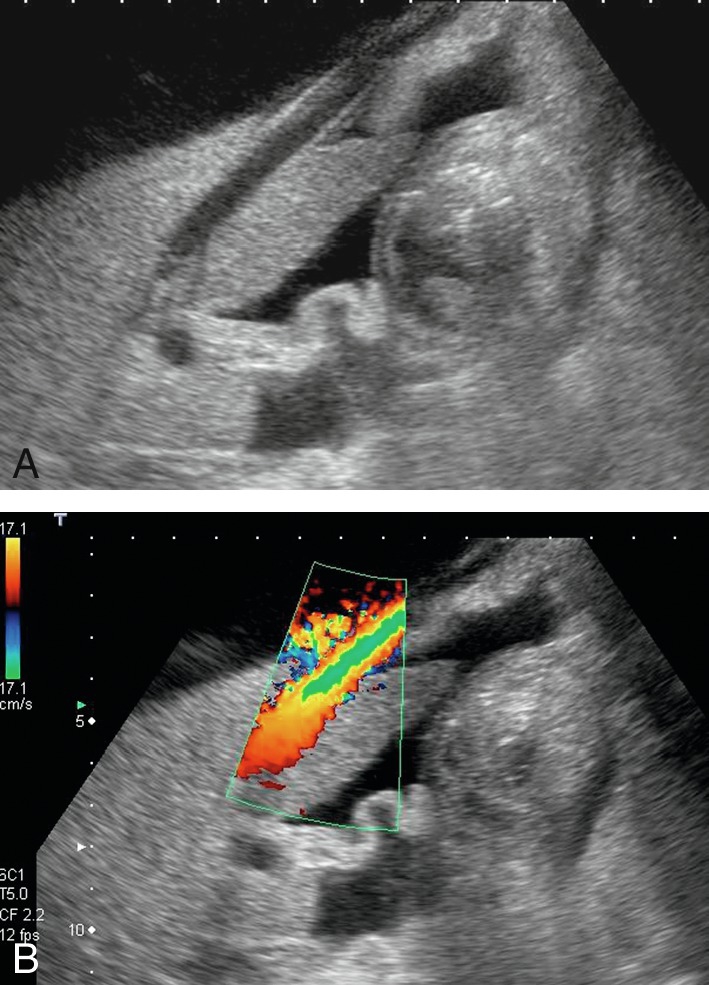 Guide pratique d'écho-Doppler vasculaire