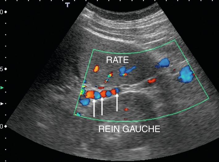 Guide pratique d'écho-Doppler vasculaire