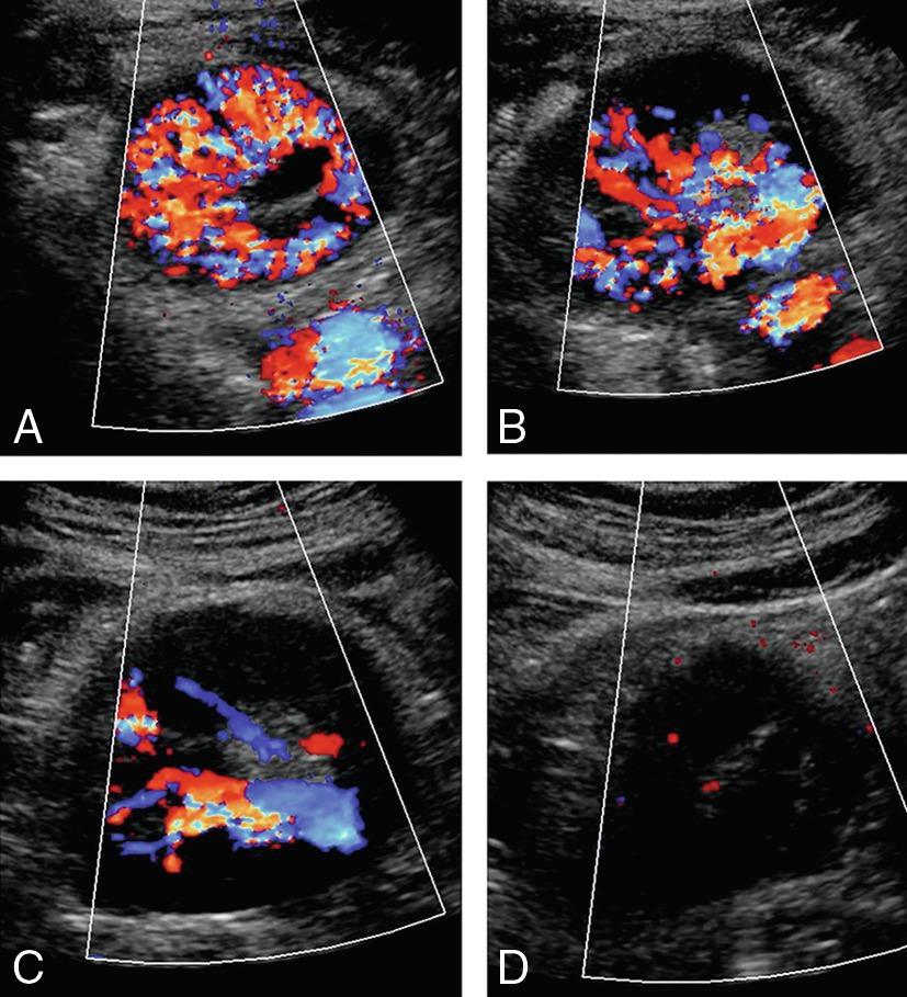 Guide pratique d'écho-Doppler vasculaire