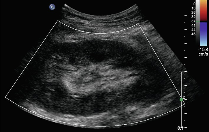 Guide pratique d'écho-Doppler vasculaire