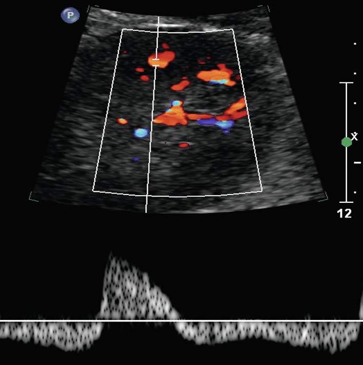 Guide pratique d'écho-Doppler vasculaire