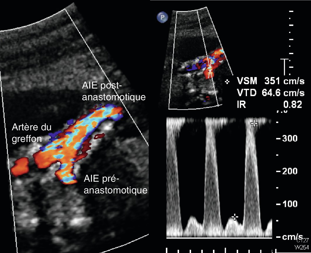 Guide pratique d'écho-Doppler vasculaire