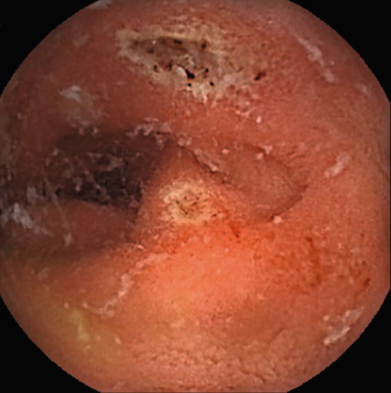 Hépato-gastro-entérologie