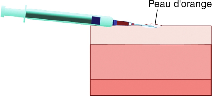 Fiches de soins infirmiers