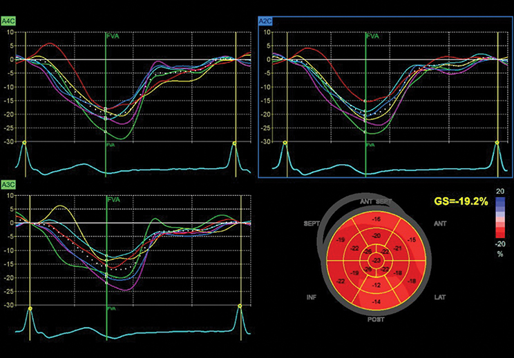 Guide pratique d'échocardiographie