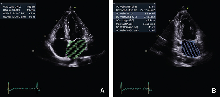 Guide pratique d'échocardiographie