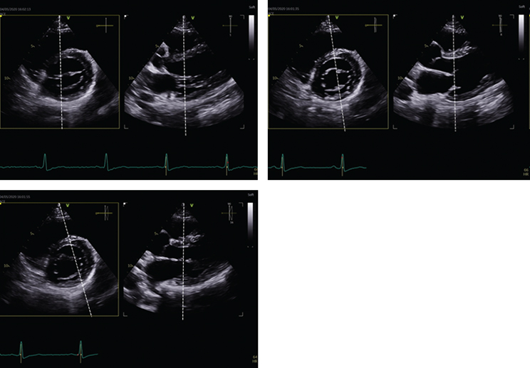Guide pratique d'échocardiographie
