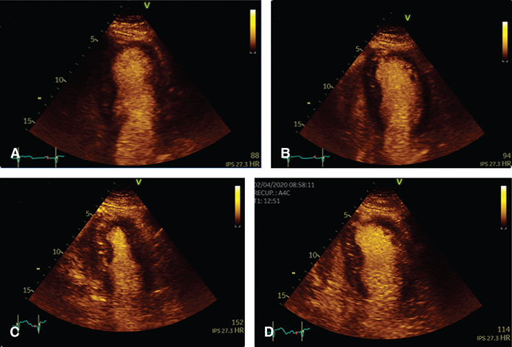 Guide pratique d'échocardiographie