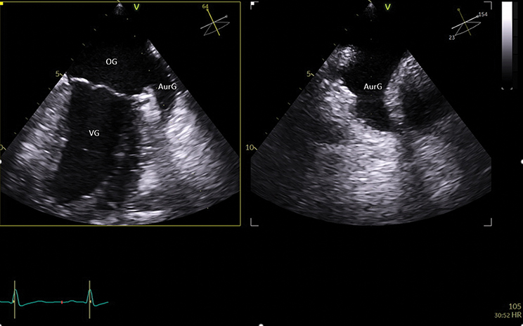 Guide pratique d'échocardiographie