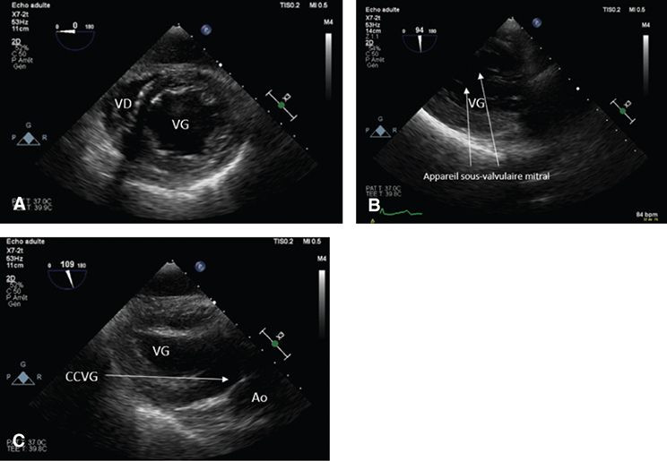 Guide pratique d'échocardiographie