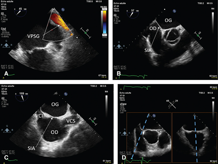 Guide pratique d'échocardiographie