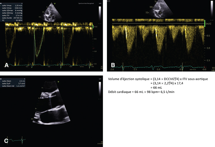 Guide pratique d'échocardiographie