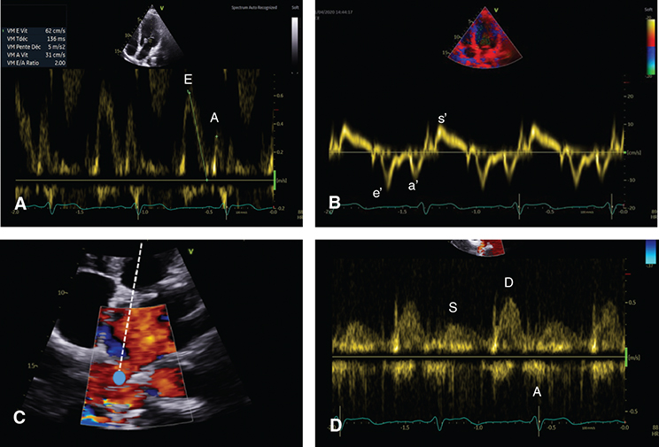 Guide pratique d'échocardiographie