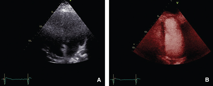 Guide pratique d'échocardiographie