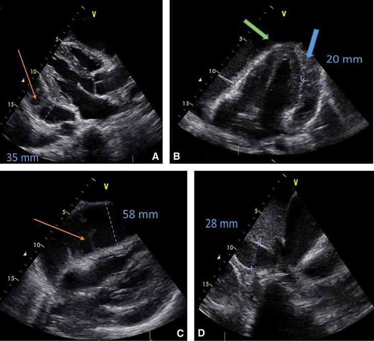 Guide pratique d'échocardiographie