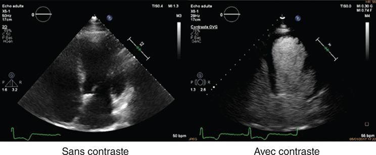 Guide pratique d'échocardiographie
