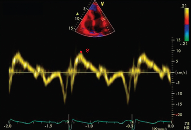 Guide pratique d'échocardiographie