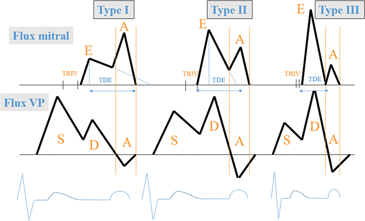 Guide pratique d'échocardiographie