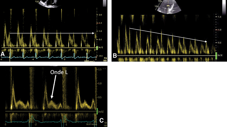 Guide pratique d'échocardiographie