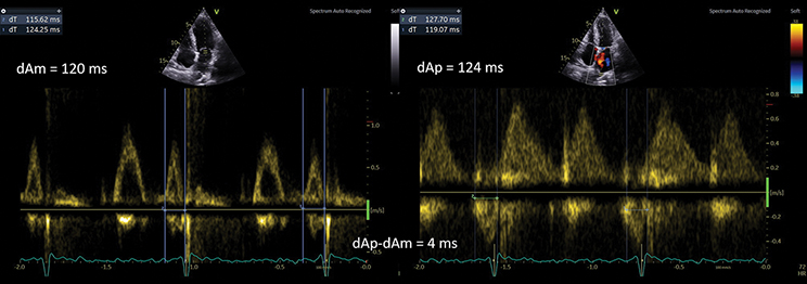 Guide pratique d'échocardiographie