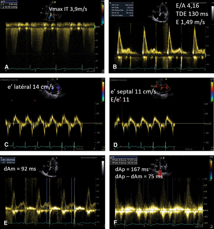 Guide pratique d'échocardiographie