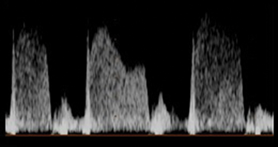 Guide pratique d'échocardiographie