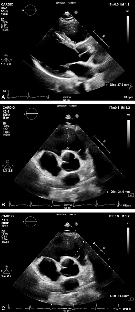 Guide pratique d'échocardiographie