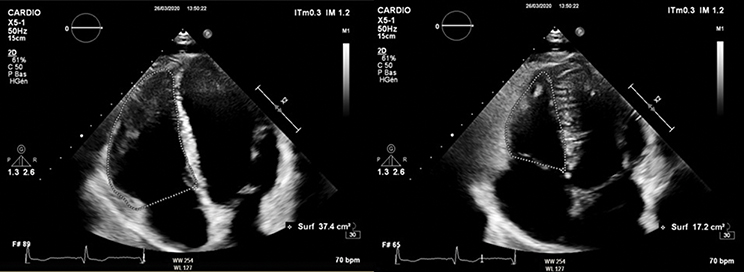 Guide pratique d'échocardiographie