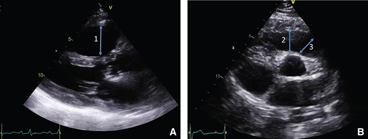 Guide pratique d'échocardiographie