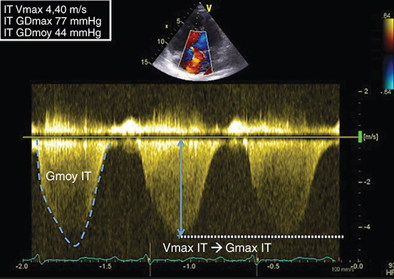 Guide pratique d'échocardiographie