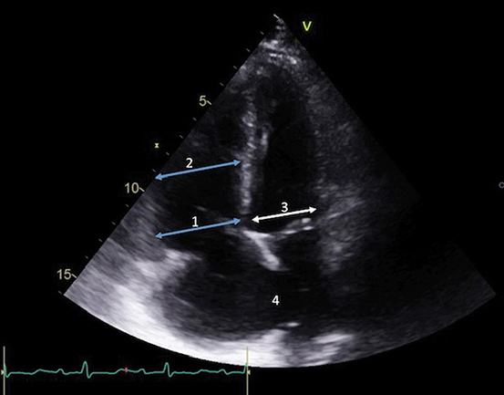 Guide pratique d'échocardiographie