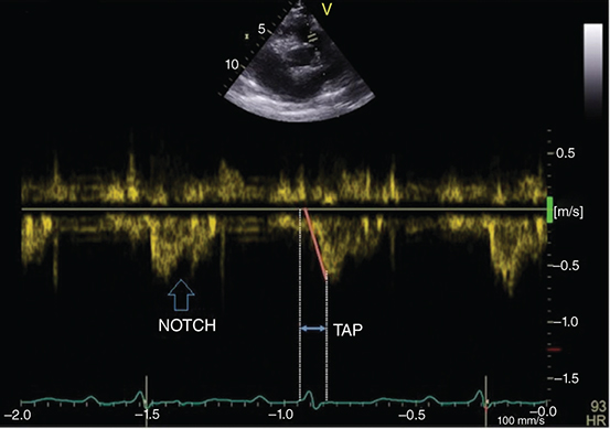 Guide pratique d'échocardiographie