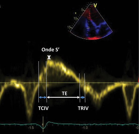Guide pratique d'échocardiographie
