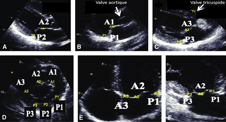 Guide pratique d'échocardiographie