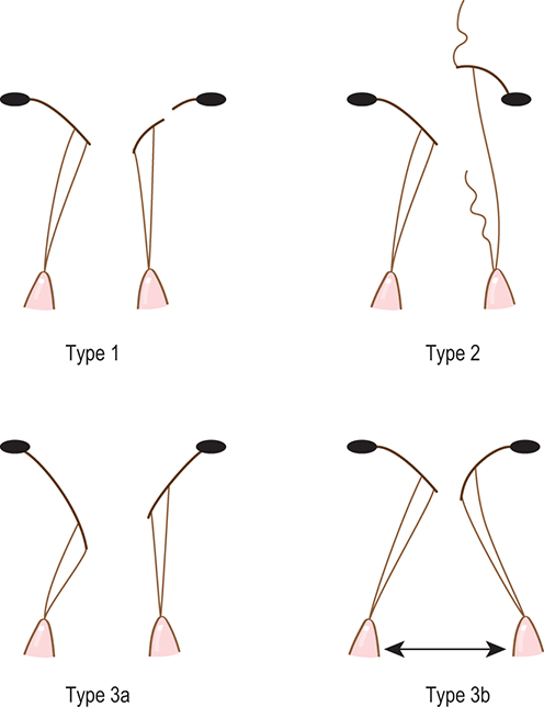 Guide pratique d'échocardiographie