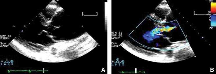 Guide pratique d'échocardiographie