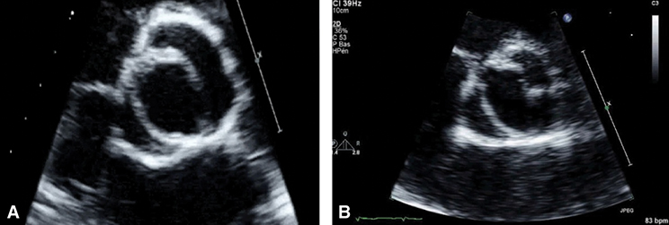 Guide pratique d'échocardiographie